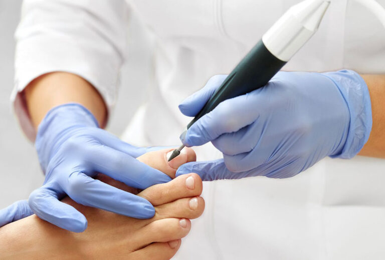 What Is a Foot Doctor Called? | IDCC Health Brooklyn